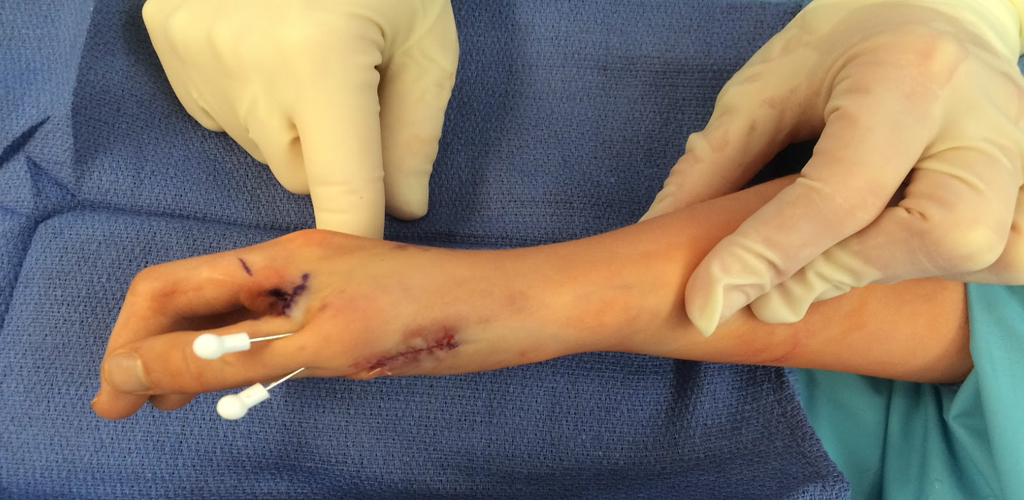 Hand Wrist Ankle And Foot Microsurgeon